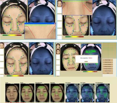 Cina analizzatore facciale 40W della pelle dell'analizzatore della pelle di dermatologia 3d della macchina facciale di analisi in vendita