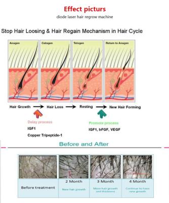 Cina macchina terapeutica 50Hz di crescita dei capelli del laser Nti di crescita galvanica dei capelli di 650nm in vendita