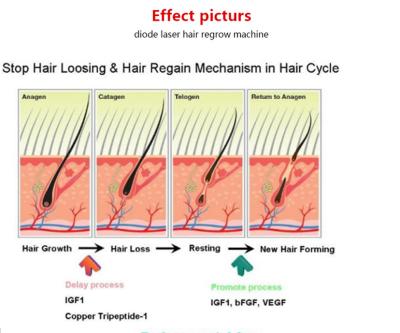 Cina Macchina multifunzionale 38kg di crescita dei capelli del laser a diodi di 10mw 650nm in vendita
