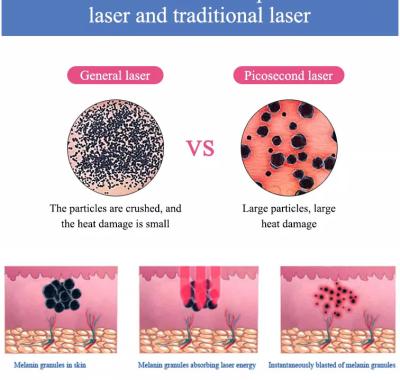 Cina Macchina 755nm 808nm del ND YAG Pico Laser Picosecond Tattoo Removal in vendita