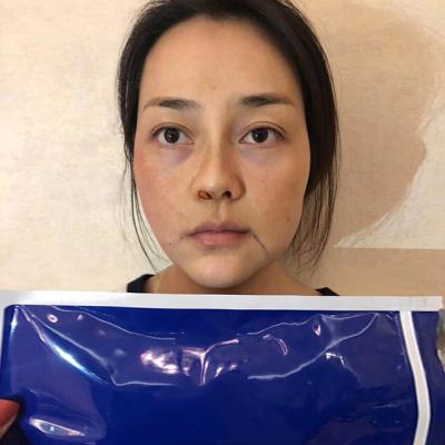 Cina Sollevamento del filo del filo 21g 60mm PDO dell'ascensore del dente di Polydioxanone Plla in vendita