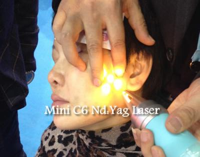 Cina Alta macchina del laser del ND YAG del commutatore della macchina Q del laser di Pico di potenza di picco per il tatuaggio/la depilazione in vendita