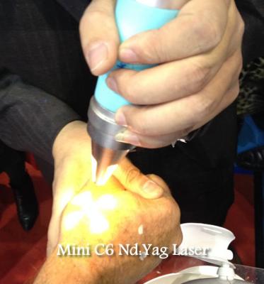 China High Energy Yag Laser Tattoo Removal Machine 1064 Nd Yag 532 Nm With CE Approved for sale