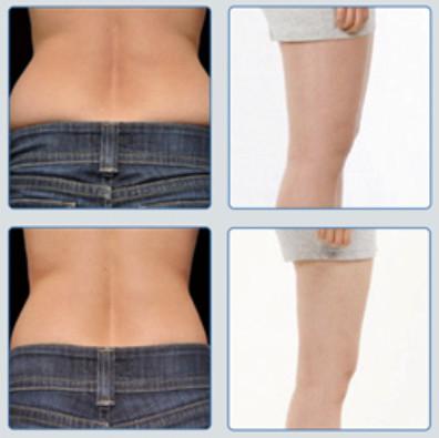 China Salon Cryo Fat Freezing Machine , Cryo Lipo Fat Freeze Equipment For Fast Fat Reduction for sale