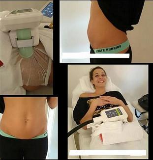 China Salon Cryo Fat Freezing Machine , Cryo Lipo Fat Freeze Equipment For Fast Fat Reduction for sale