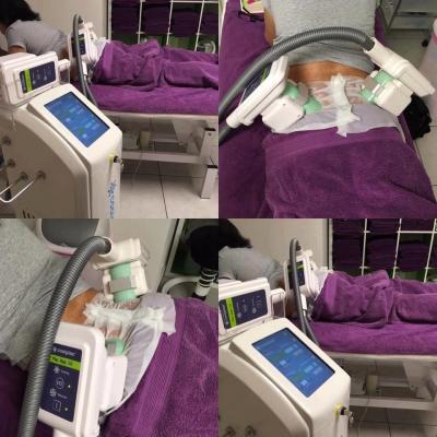 China OEM/ODM Vet Bevriezend Vermageringsdieet 2 Machine van de Hoofden de Gelijktijdige Werkende Vette Vermindering Te koop