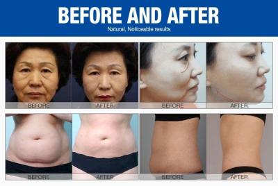 China Ultrasound 3D Machine 15 