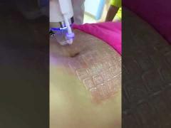 Microneedle Rf Machine Skin Rejuvenation Beauty Machine radiofrecuencial facial portatil
