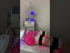 Salón multifuncional del Liposuction de la máquina de la belleza del laser de Kryolipolyse del retiro gordo