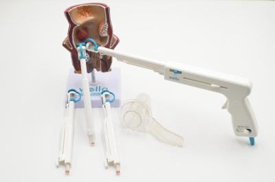 Cina Cucitrice meccanica circolare emorroidale indolore con il brevetto esclusivo di Anoscope nessun argomenti del corpo estraneo in vendita