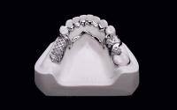 China OEM Removable Restoration Cast Partial Denture Framework Vitallium 2000 for sale