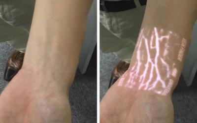 Cina Vene infrarosse professionali mediche del ritrovamento di Transilluminator dello spettatore della vena per la flebotomia in vendita