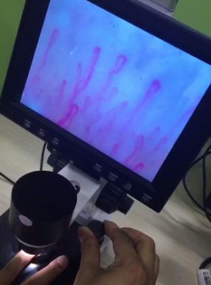 Cina Microscopio di microcircolazione di Next Generation, microscopio del vaso sanguigno per la sanità in vendita