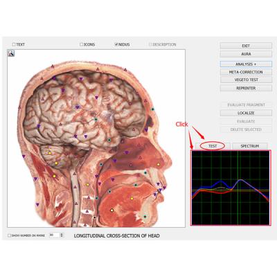 Cina sistemi diagnostici 8d NLS di Bio--risonanza/macchina del sistema di analisi di salute corpo di 9D NLS in vendita