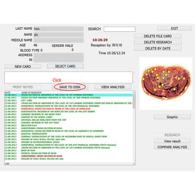 Cina i lris di 8d 9d 18d Vector l'analizzatore pieno di salute del corpo di NLS con software originale in vendita