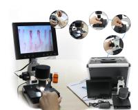 China 600cd/m2 Microcirculation Microscope Nailfold Capillary Test Connected To Laptop for sale
