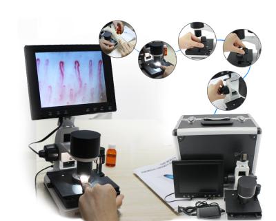 China teste capilar do Nailfold do microscópio do Microcirculation 600cd/m2 conectado ao portátil à venda