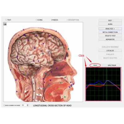 Cina Software libero dell'aggiornamento per l'attrezzatura di salute del corpo di versione 8D NLS/analizzatore clinici del corpo in vendita