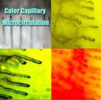 China Hospital Nailfold Capillary Microscopy /  Microcirculation Microscope Multi Function for Medical for sale