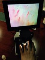 China CE Approved OEM LCD Screen Color Microcirculation Microscope for Nail Checking for sale