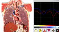 China Body Analyzer Metatron NlS Hunter Version for sale