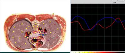 Cina Macchina meridiana di sistema diagnostico di salute dell'analizzatore del corpo del cacciatore di Metatron NLS 4025 della prova in vendita