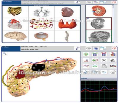 Cina Analizzatore virtuale nero del corpo del cacciatore di Metatron NLS 4025 di alta precisione di esame multilingue in vendita