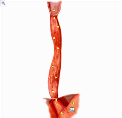 Cina Spettro dei minerali e del cacciatore di Metatron NLS 4025 di trattamento delle gemme per l'apparecchiatura di collaudo cardiovascolare in vendita