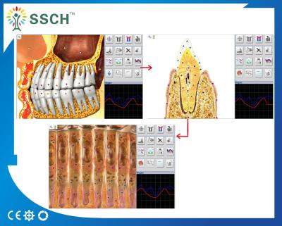 Cina Cacciatore portatile di Metatron NLS 4025 dell'analizzatore di salute di biofeed-back per alta precisione del rivelatore di Quantum in vendita
