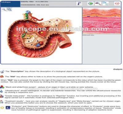 China Inteligência mais rápida estável da ressonância da vida do monitor do analisador do caçador 4025 de Metapathia GR à venda