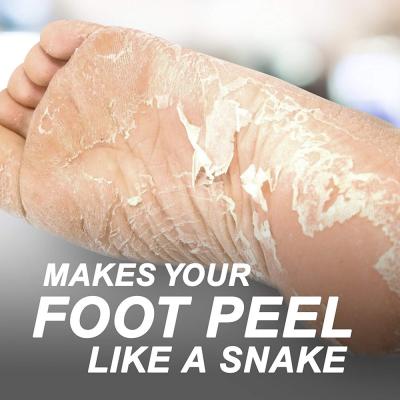 Cina Aloe Vera Foot Peeling Mask, calzini morti liberi del piede del dispositivo di rimozione della pelle del Paraben naturale in vendita