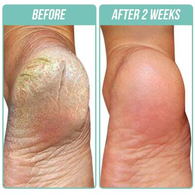 Cina Aloe Vera Foot Peeling Mask, calzini morti liberi del piede del dispositivo di rimozione della pelle del Paraben naturale in vendita