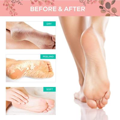 Cina La maschera esfoliante di pelatura naturale Dermatologically del piede ha provato Exfoliator in vendita