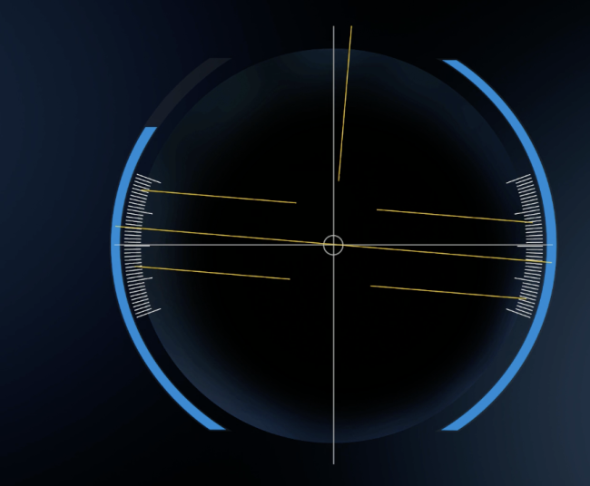 VISUMAX 800 technical specifications diagram