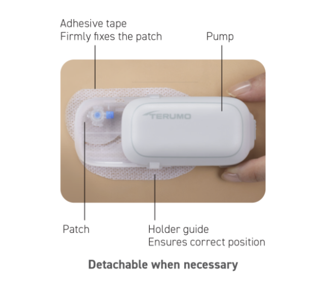 Terumo Medisafe WITH Insulin Patch Pump - Remote Control