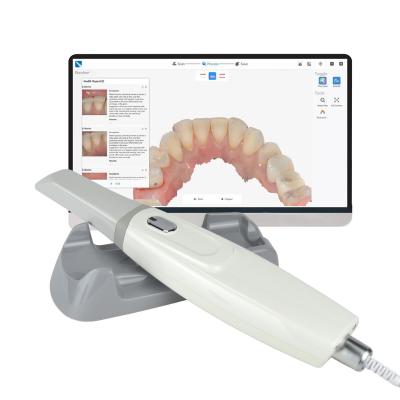 中国 AI搭載ソフトウェア付き歯科用口腔内スキャナー 90秒フルアーチスキャン 販売のため