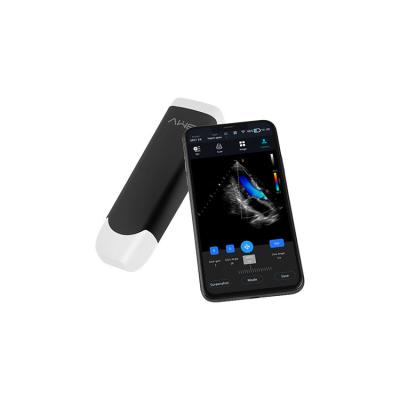 China Draagbare Handbediende Draadloze Sondetype Ultrasone klankscanner 2mhz Te koop
