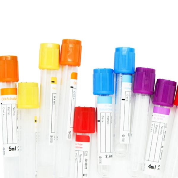 Anpassung 10 ml Blutentnahme Schlauch Einwegglas Plastik Lavendelkappe