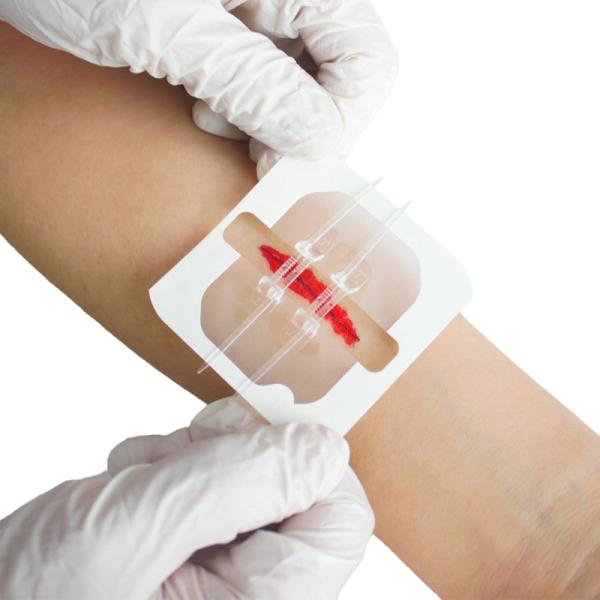 Quality Wound Closure Device, Flexible Fabric Bandages, 2 / 4 / 6PCS for sale