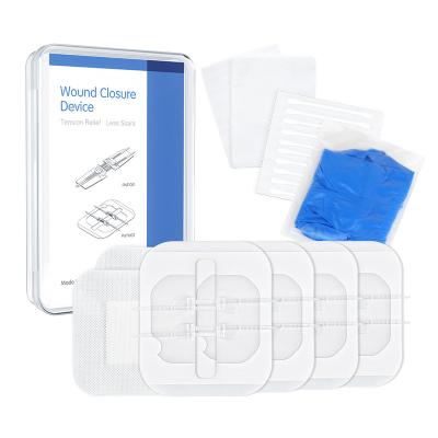 Quality Wound Closure Device, Flexible Fabric Bandages, 2 / 4 / 6PCS for sale