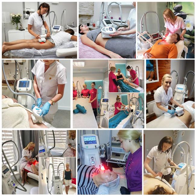 Velashape slimming amchine customer feedback