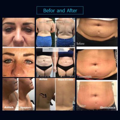 Cina Professionale Terma Sculpt Vela Machine Rf Vacuum Cavitation Butt Lifting in vendita