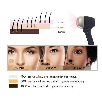 China IJst Titanium pijnvrije diode laser ontharing machine prijs Te koop