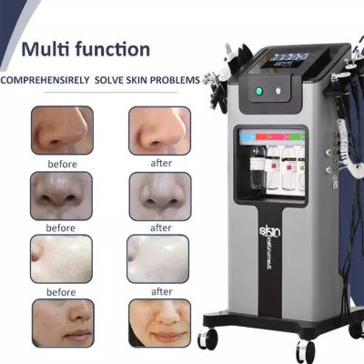 Cina Black Pearl Kin Management Oxygen Facial Machine / Dispositivo Multifunzione 500w in vendita