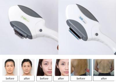 中国 しわの取り外し/皮の若返りのための多機能の垂直EライトIPL RF機械 販売のため