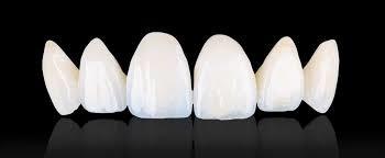 China dental non prep veneer for sale