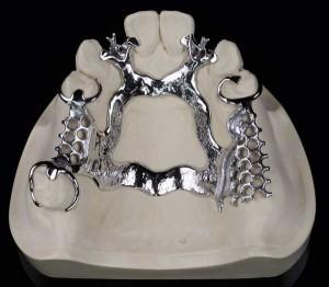 China dental metal framework for sale