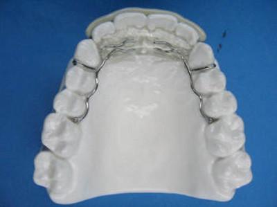 China dental spring retainer for sale