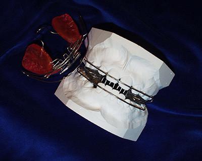 China dental bionator appliance for sale
