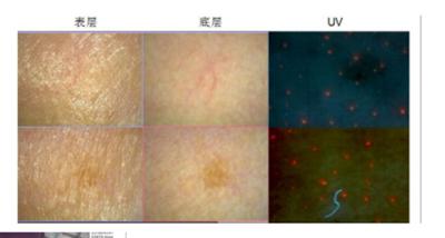 Cina Macchina portatile dell'analizzatore dell'analizzatore dei capelli dell'analizzatore della pelle di bellezza in vendita